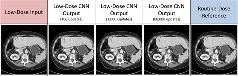 Ct Noise Reduction Methods For Lower Dose Scanning Strengths And Weaknesses Of Iterative