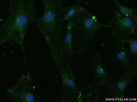 Integrin Beta 3 Antibody 83053 4 Rr Proteintech