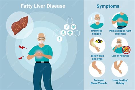 Premium Vector Non Alcoholic Fatty Liver Disease Symptoms Old Man