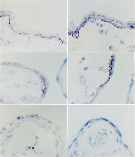Immunolocalization Of E Cadherin E Cad Ac And β Catenin Bd In Download Scientific