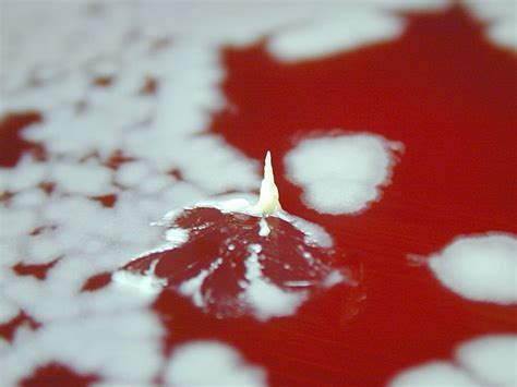 Imagen Gratis Bacilo Anthracis Gamma Fago Lisis Ovejas Agar Sangre