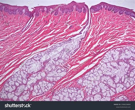 Stratified Squamous Epithelium Under Microscope