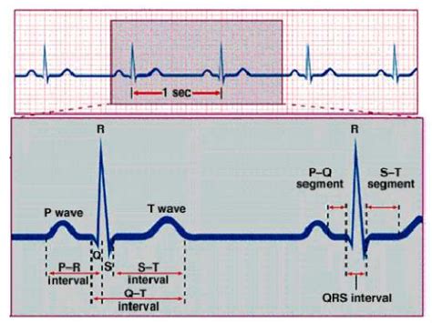 0 1 ecg signal overview ecg signal analysis for myocardial by