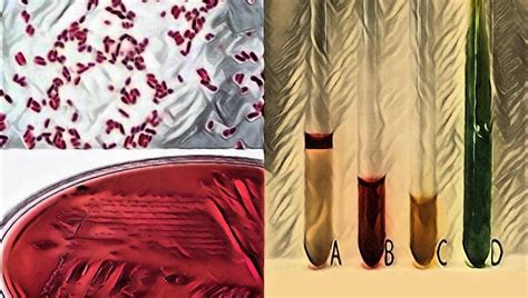 Check Out The Various Biochemical Tests For Escherichia Coli Li Laboratory Hub