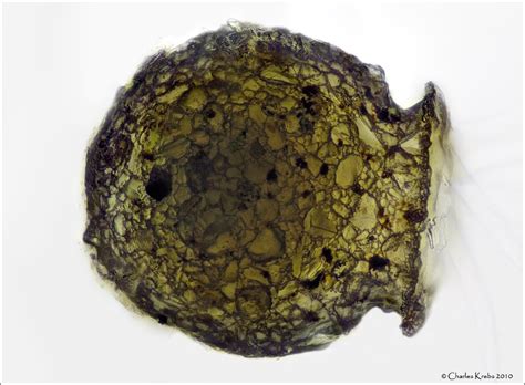 Difflugia Urceolata Attractive Test Photomacrography Net