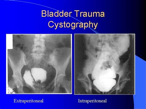 Abdominal And Genitourinary Trauma Steve Lan September 25