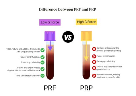 Prf Vs Prp Natural Treatments For Wrinkles Skin Rejuvenation And More