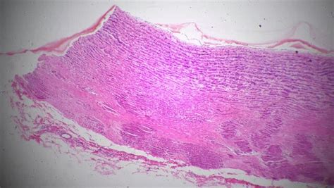 Basal Lamina Histology