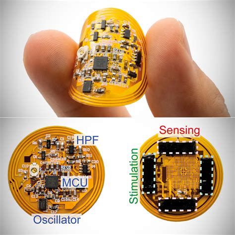 Stanford Researchers Develop Wireless Smart Bandage That Speeds Up