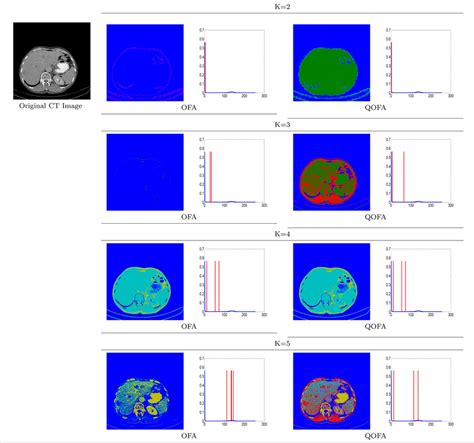 multilevel thresholding segmentation results obtained from ofa and ofa download scientific