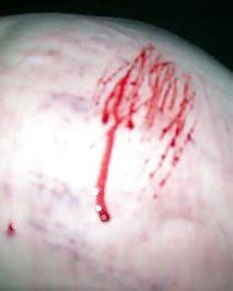 Bdsm Knife Play Porn Pictures Xxx Photos Sex Images Pictoa