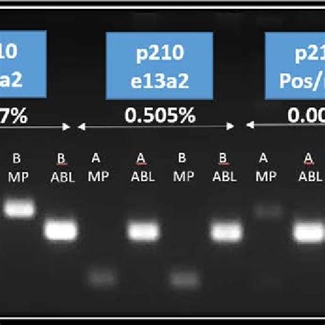 Multiplex Rt Pcr Bcrabl Transcript Variant Assay Assessment Of Neqas Download Scientific