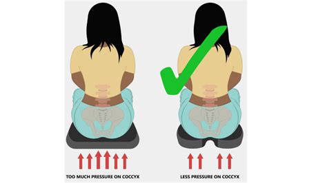 Coccyx Pain Relief