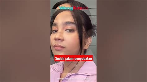 Rachel Amanda Masih Menjalani Pengobatan Kanker Tiroid Youtube