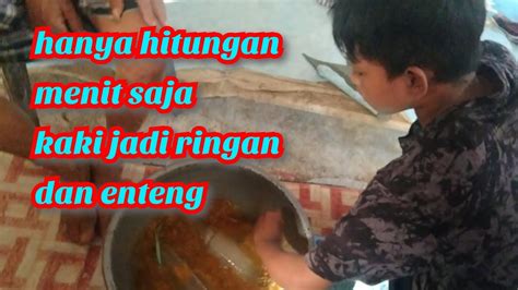 Terapi ES batu || Rendam kaki - YouTube