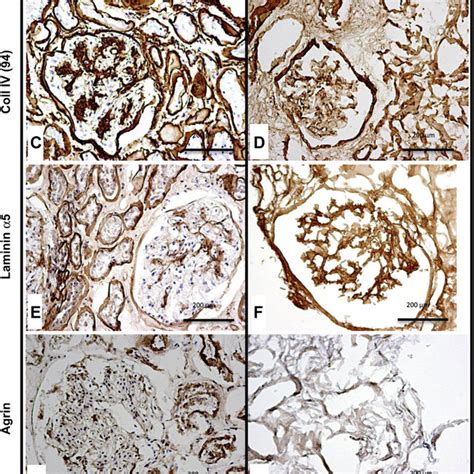 Preservation Of Ecm Molecules Immunostaining For Collagen Type Iv