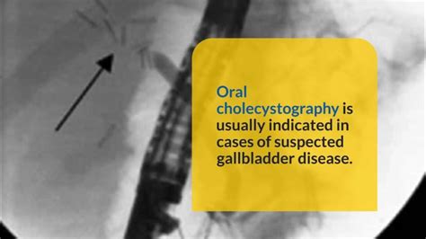 Cholecystography Education Health Healthy Learning Healing