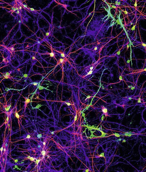 Cellules Gliales ObÉsitÉ Les Astrocytes Ces Nouveaux Players Dans