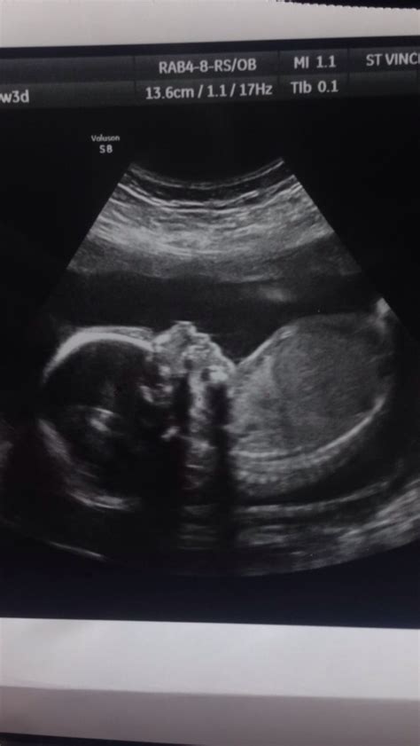 Getting My Cervix Checked Glow Community