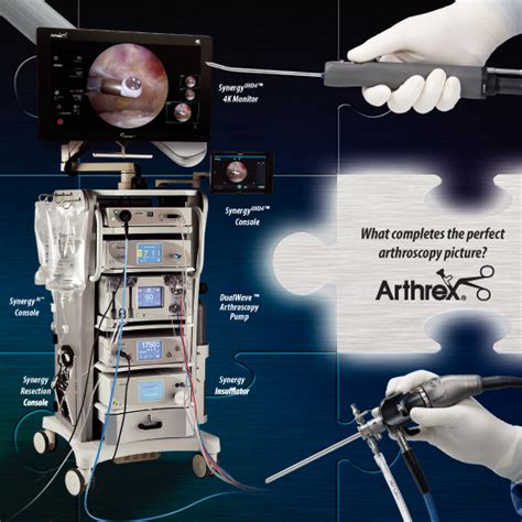 What Completes The Perfect Arthroscopy