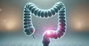 Los Casos De Cáncer De Colon Aumentan En Adultos Jóvenes Cuál Es El