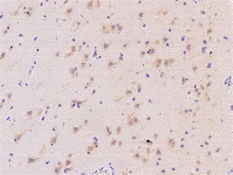 Vnn2 Vanin 2 Antibody Rabbit Mab