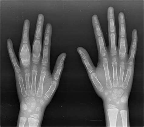 Pin Di Dr Puiu Harold Su Radiology