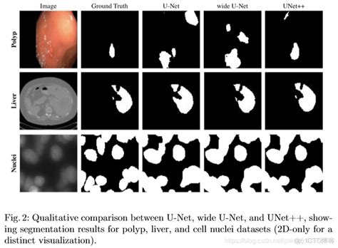 全卷积神经网路【u Net项目实战】unet 51cto博客 全卷积神经网络