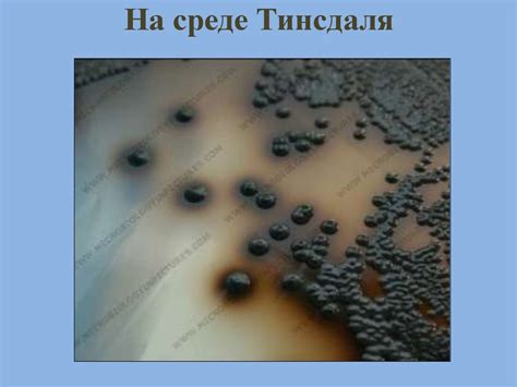 Corynebacterium Striatum Antibiotic Coverage