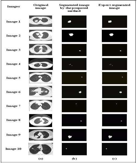 Segmentation Result By The Proposed Method A Original Images B Download Scientific Diagram