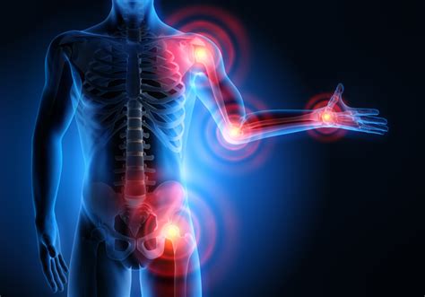 10 Common Causes Of Joint Pain Painscale