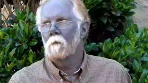 Strange Case Of The Us Man Who Permanently Turned Himself Blue