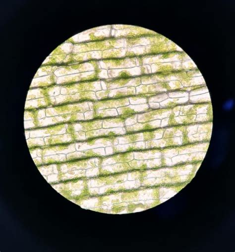 Elodea Cells Under A Microscope