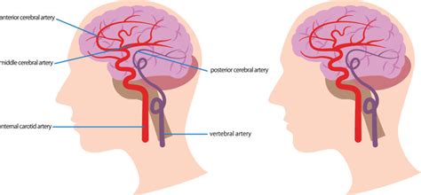 Internal Carotid Artery Brain