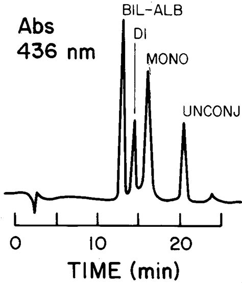 The Clinical Importance Of A Protein Bound Fraction Of Serum Bilirubin In Patients With