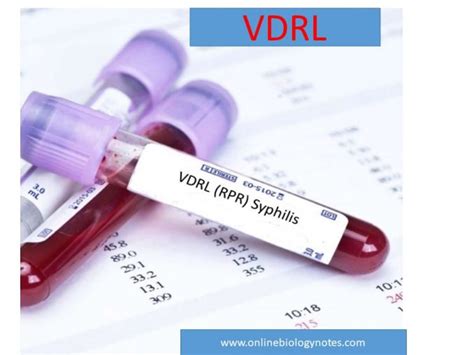 Rpr Test Principle Procedure Result Interpretation And Application Online Biology Notes