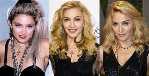 Celebrity Plastic Surgery Before And After 2020