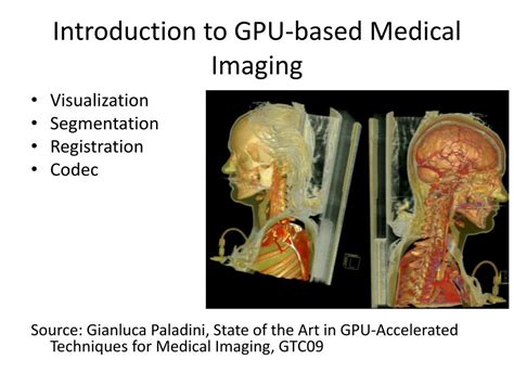 PPT Some Applications Of GPU Based Medical Imaging PowerPoint Presentation ID
