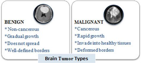 Classification Of Brain Tumors Download Scientific Diagram