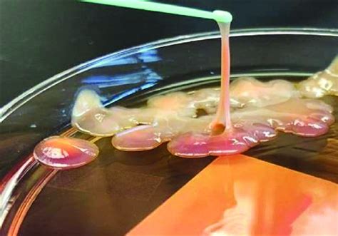 Positive String Test String Formation Of 5 Mm When Colony Was Touched