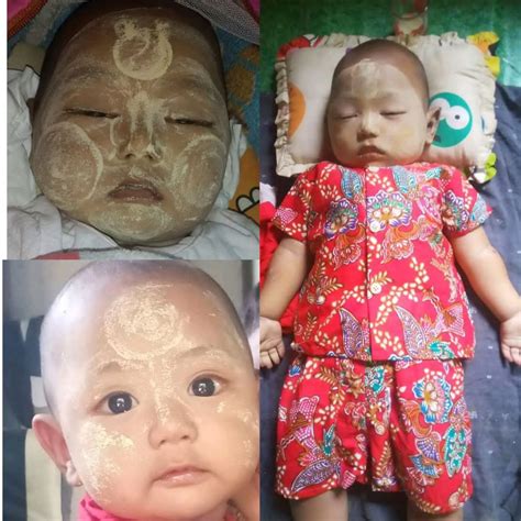 M E သူငယ်နာနဲ့ဆေးရုံတက်တာ ဆေးအလုံး၄၀တစ်ကြိမ် ၂၀တစ်ကြိမ်ထိုးပြီးခဏအကြာ