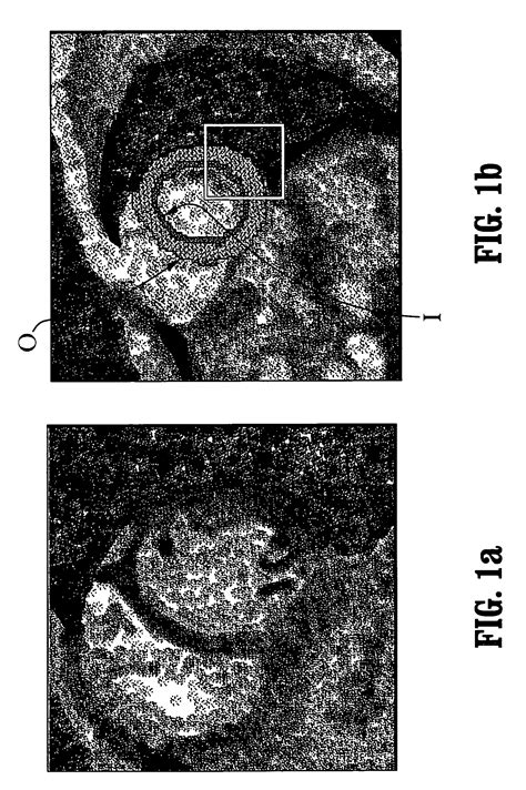 Vector Flow Patented Technology Retrieval Search Results Eureka Patsnap