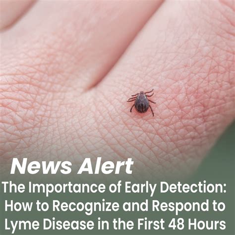 The Importance Of Early Detection How To Recognize And Respond To Lyme Disease In The First 48