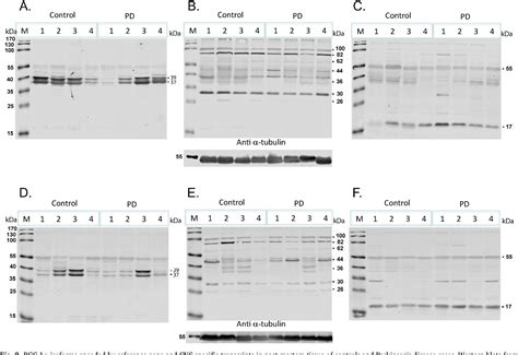 Figure 2 From The Ppargc1a Locus And Cns Specific Pgc 1α Isoforms Are Associated With Parkinson