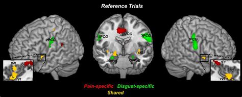 Neural Structures Associated With Modality Specific And Modality Shared