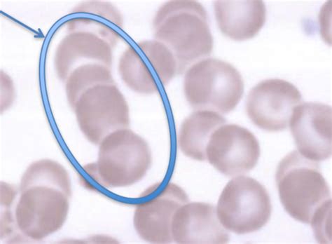 Non Regenerative Anemia Flashcards Quizlet