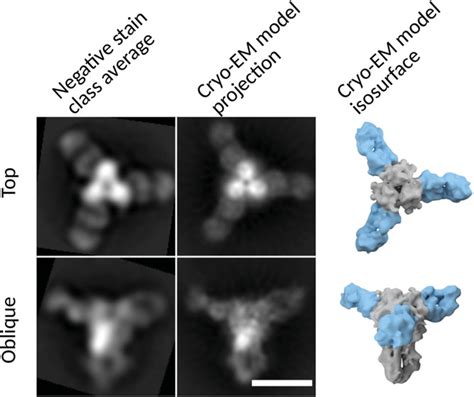 Negative Stain Results Compared To Cryo Em The Left Column Highlights