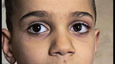 💔🙏მძიმედ დაავადებულ და ყოველთვის მშიერ ძმებს არც წამლები აქვთ და არც საკვები Youtube