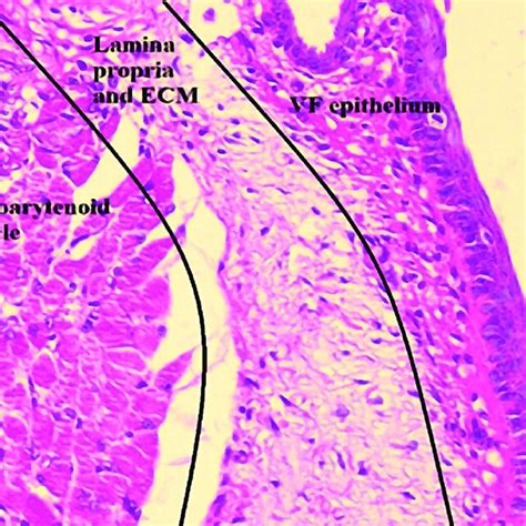 Histological Layers Of The Normal Rat Vocal Fold The Three Layers Of