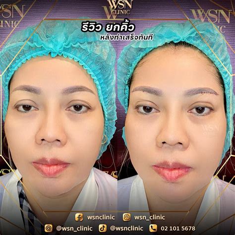 รีวิว Wsn Clinic คลินิกเวชกรรม สาขาปิ่นเกล้า